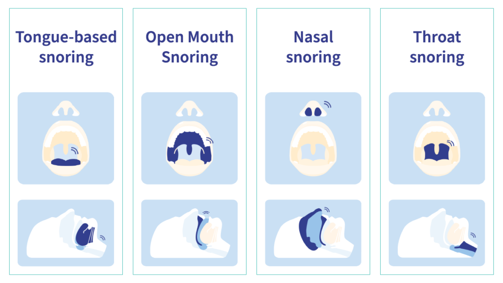 Snoring blog category - SomniShop