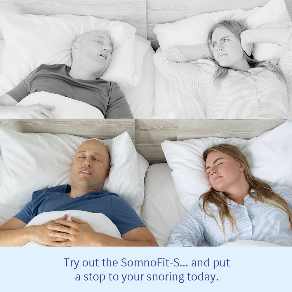 SomnoFit-S high-end Mandibular Advancement Device | SomniShop